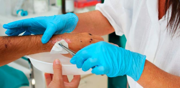 WWIWCC vs. Traditional Wound Programs: Key Tools & Info